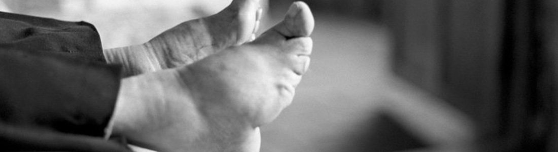 What is Foot Binding?