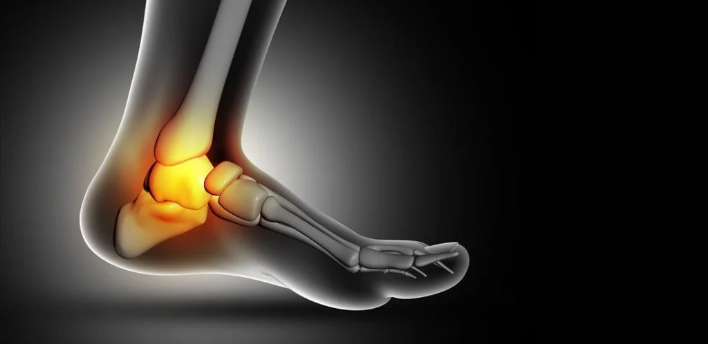 Bone Foot Stress Fractures Of The Foot And Ankle OrthoInfo AAOS